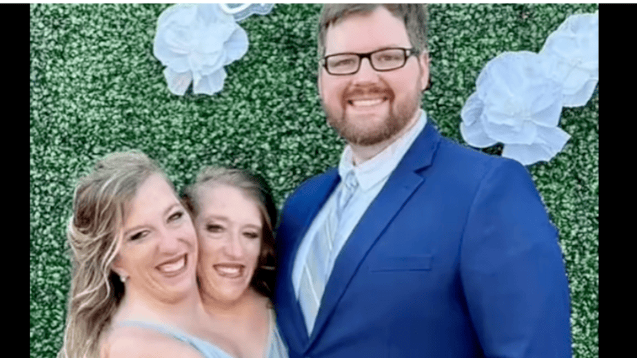 Husband of Conjoined Twins Hit with Paternity Suit - The Celeb Talk Guy Husband of Conjoined Twins Hit with Paternity Suit - The Celeb Talk Guy